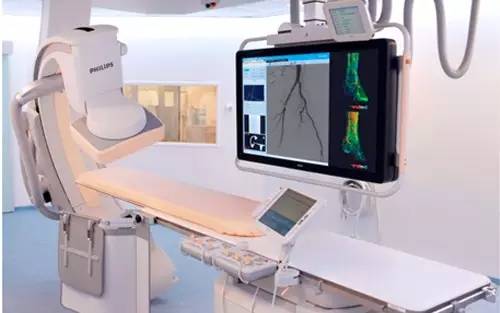 双期XperCT+EmboGuide在TACE中应用与病例分享